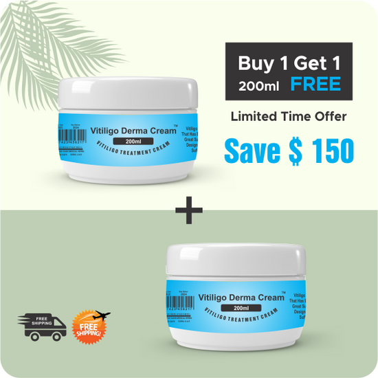 Vitiligo Derma Cream - Best Vitiligo Treatment Cream – Vitiligo Natural ...
